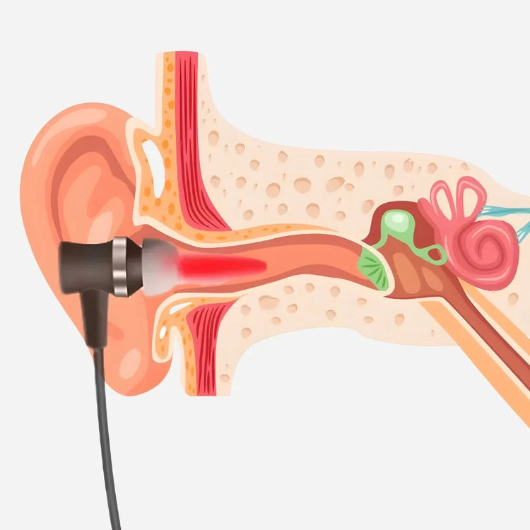 How it works explained – ReHears